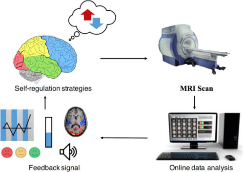 Functional MRI Neuroimaging – NTC Research Network